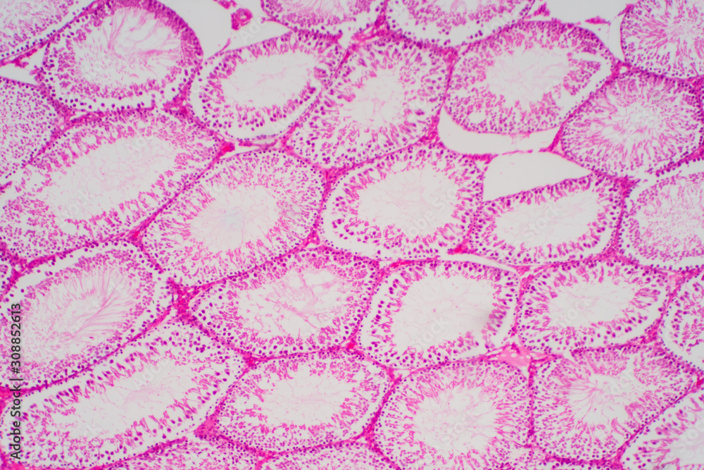 Human sperm in the testis morphology under microscope. Stock Photo ...