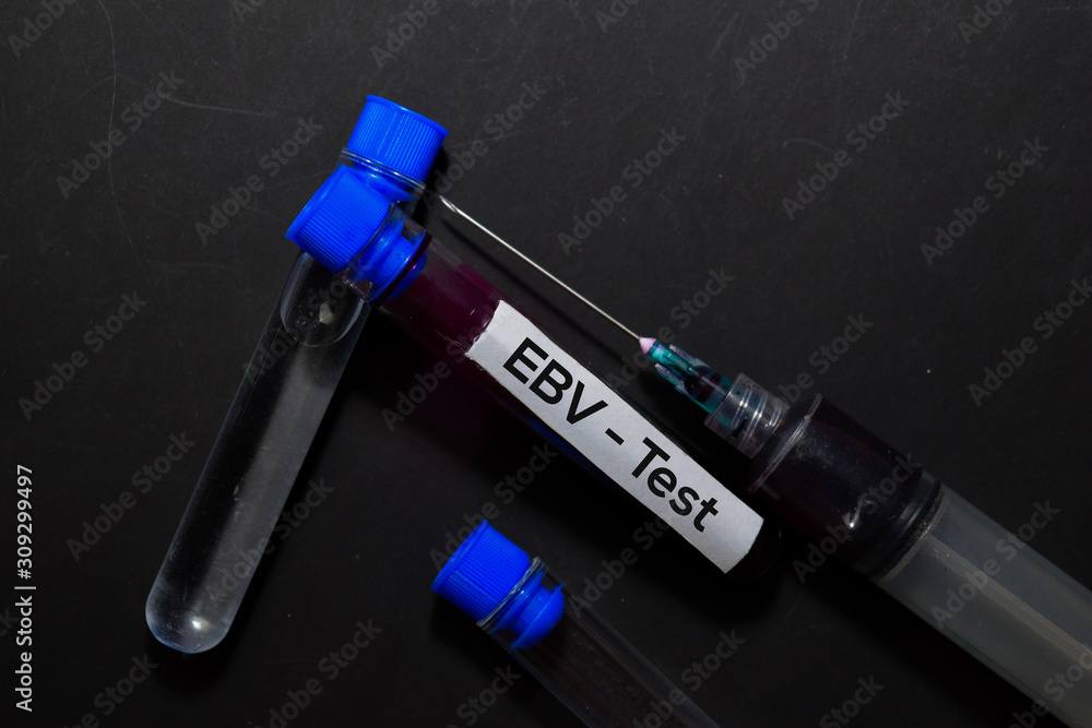 EBV - Test with blood sample. Top view isolated on office desk ...