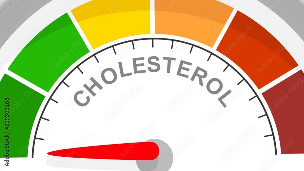 Cholesterol meter read high level result. Color scale with arrow from ...