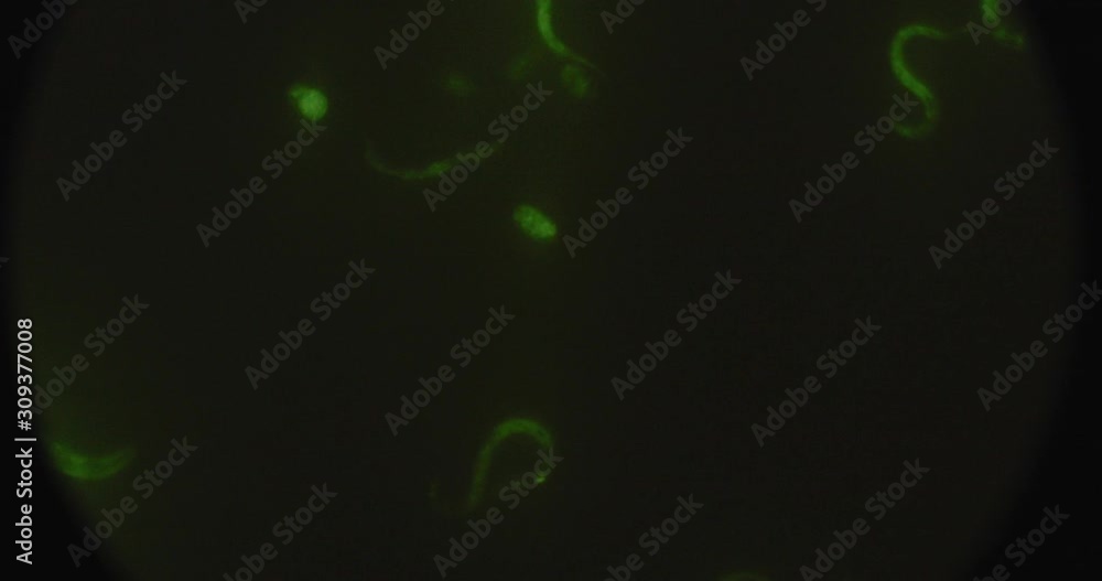 Highlighted green microorganisms, c-elegans (Caenorhabditis elegans) nematode worms under the ...