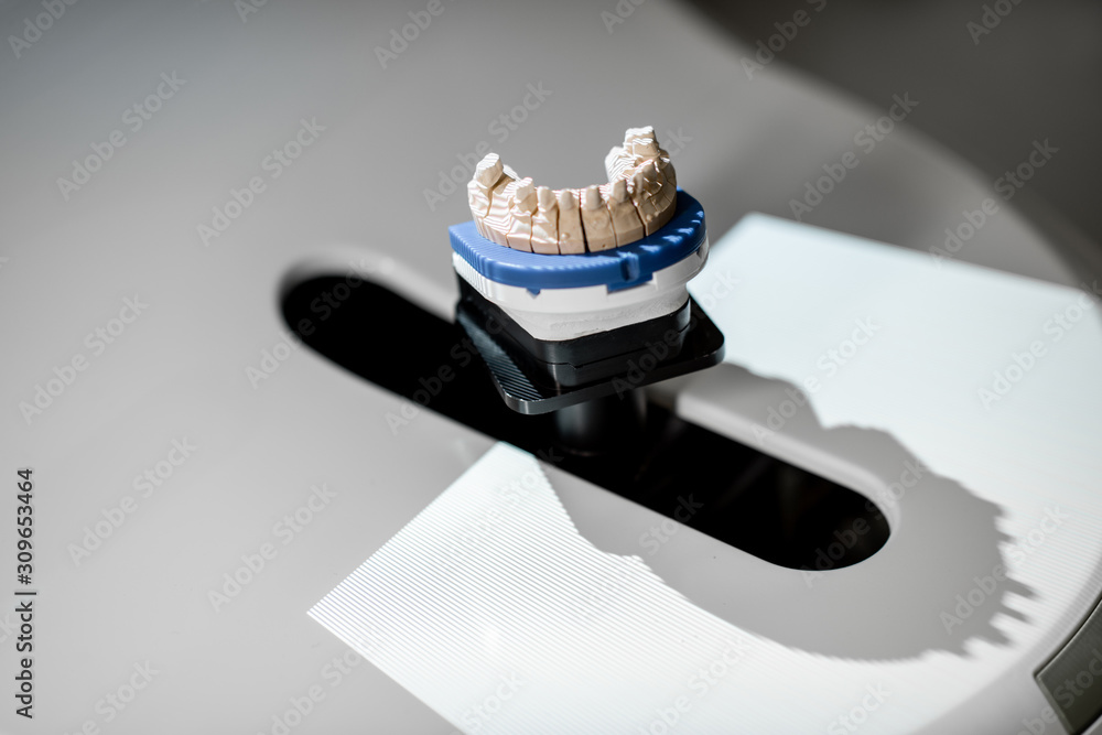 Scanning jaw model on the 3rd scanner in the laboratory, for the ...