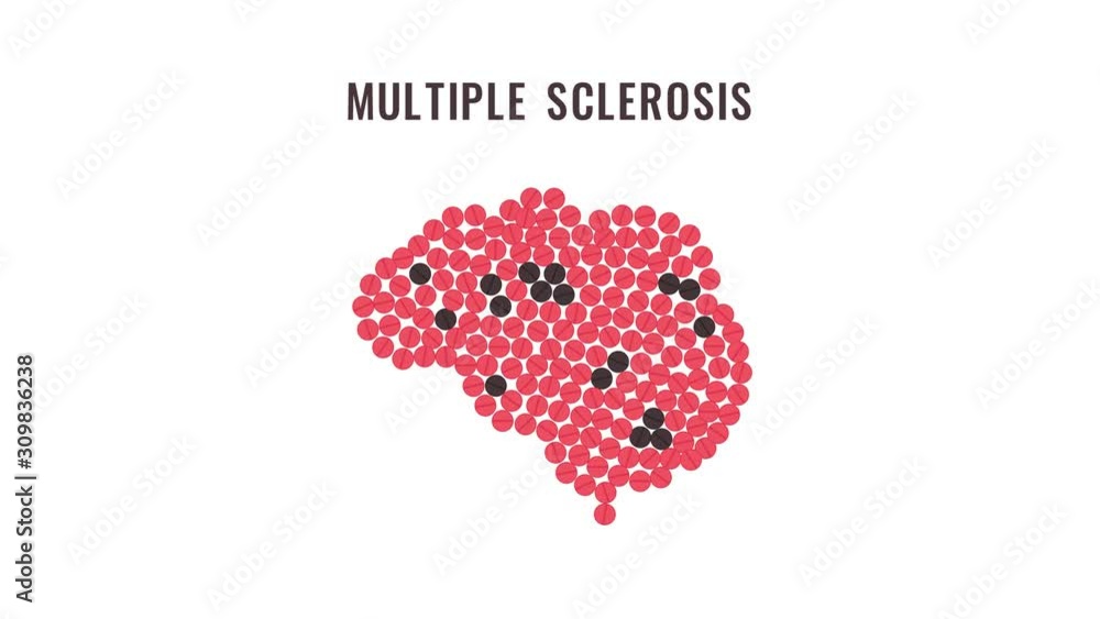 Multiple sclerosis awareness animation with brain made of pills. MS ...