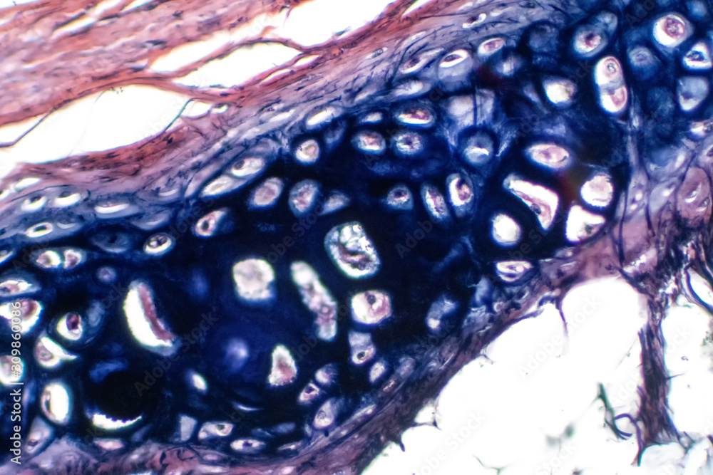 Human hyaline cartilage bone under microscope view for education ...
