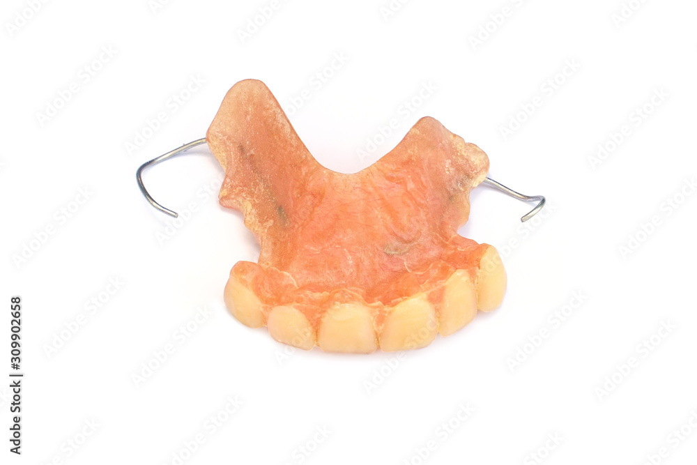 upper denture, false teeth, Partial denture upper side. Isolated on ...