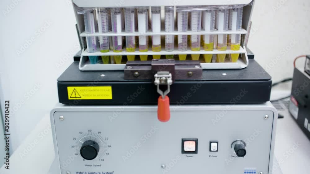 Medical equipment. Lab test tubes vortex mixer. Test results Stock ビデオ ...