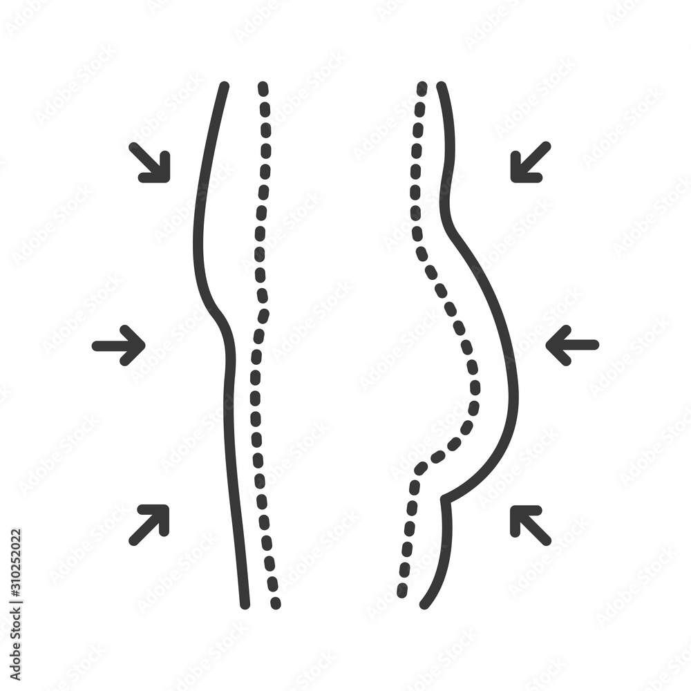 Liposuction black line icon. Fat removal surgery concept. Plastic body ...