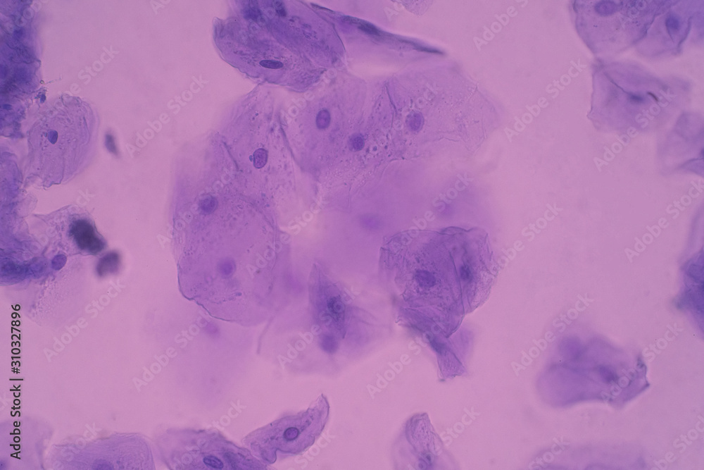 Human Cheek Epithelial Cells. The tissue that lines the inside of the ...