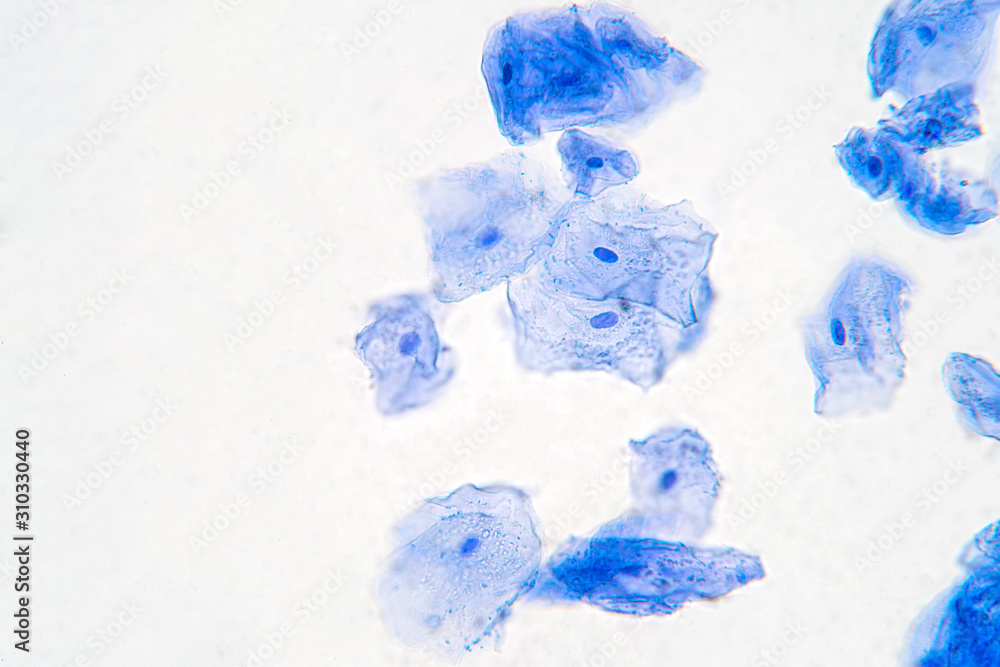 Human Cheek Epithelial Cells. The tissue that lines the inside of the ...