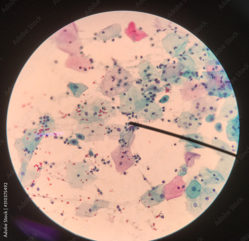 Cells in reproductive female cytology and histology concept. Stock ...