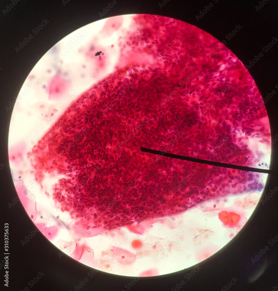 Cells in reproductive female cytology and histology concept. Stock ...