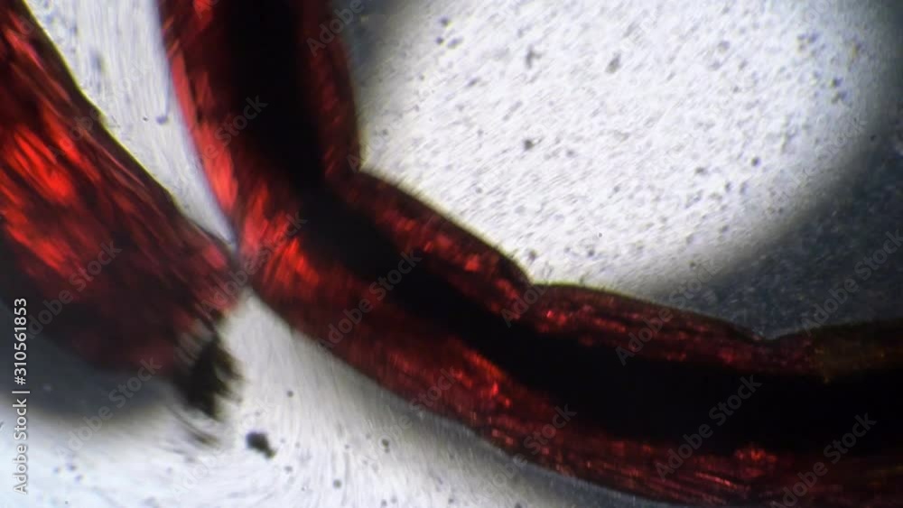 The red larva of the mosquito is translucent in a microscope. The theme ...