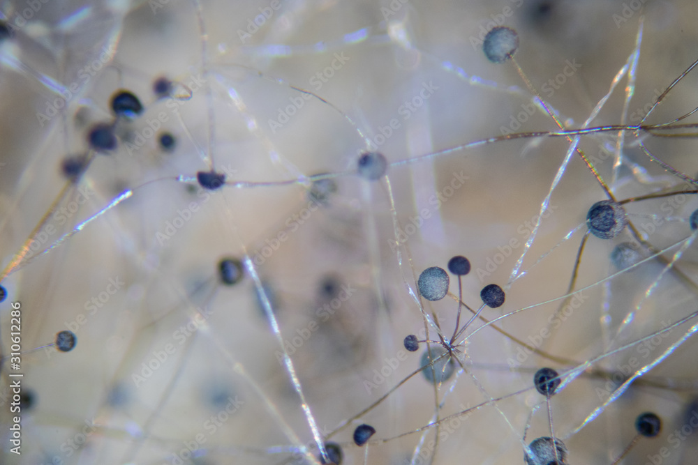 Rhizopus Mold