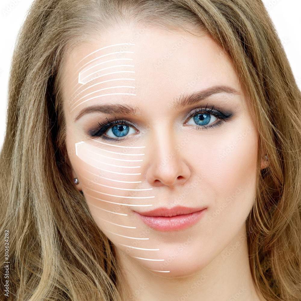 Graphic lines shows facial lifting effect on skin of beautiful woman ...