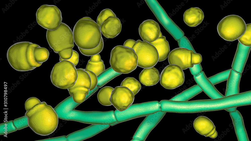 Tinea Versicolor Microscopic