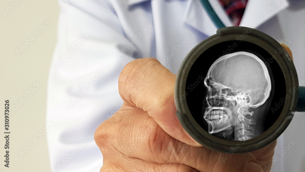 Neurologist doctor check and show film X ray radiograph of human bone ...