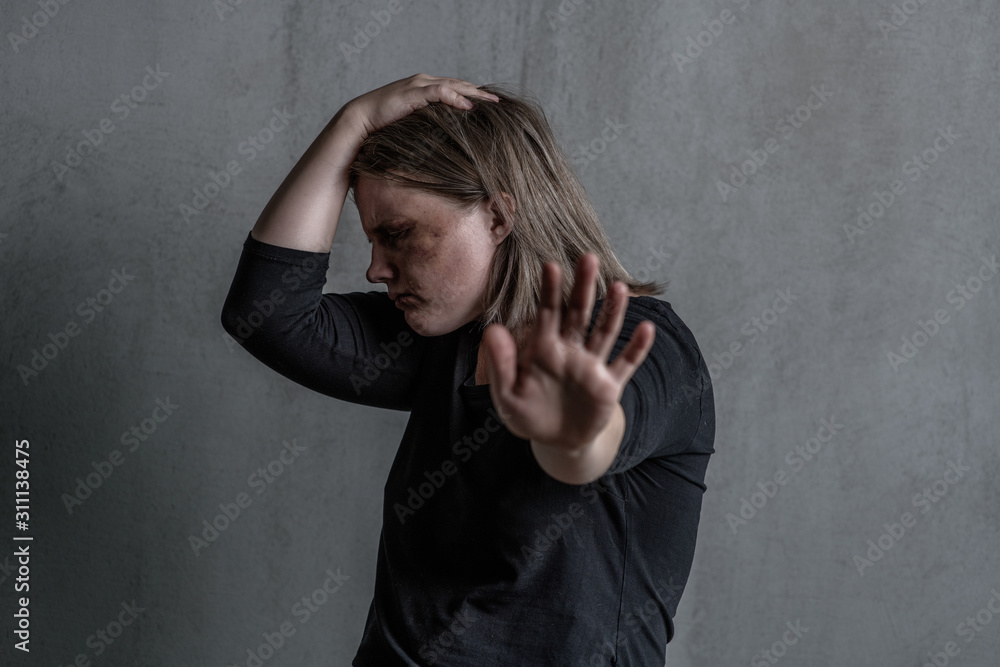Foto de Crying woman victim of domestic violence and abuse showing a ...