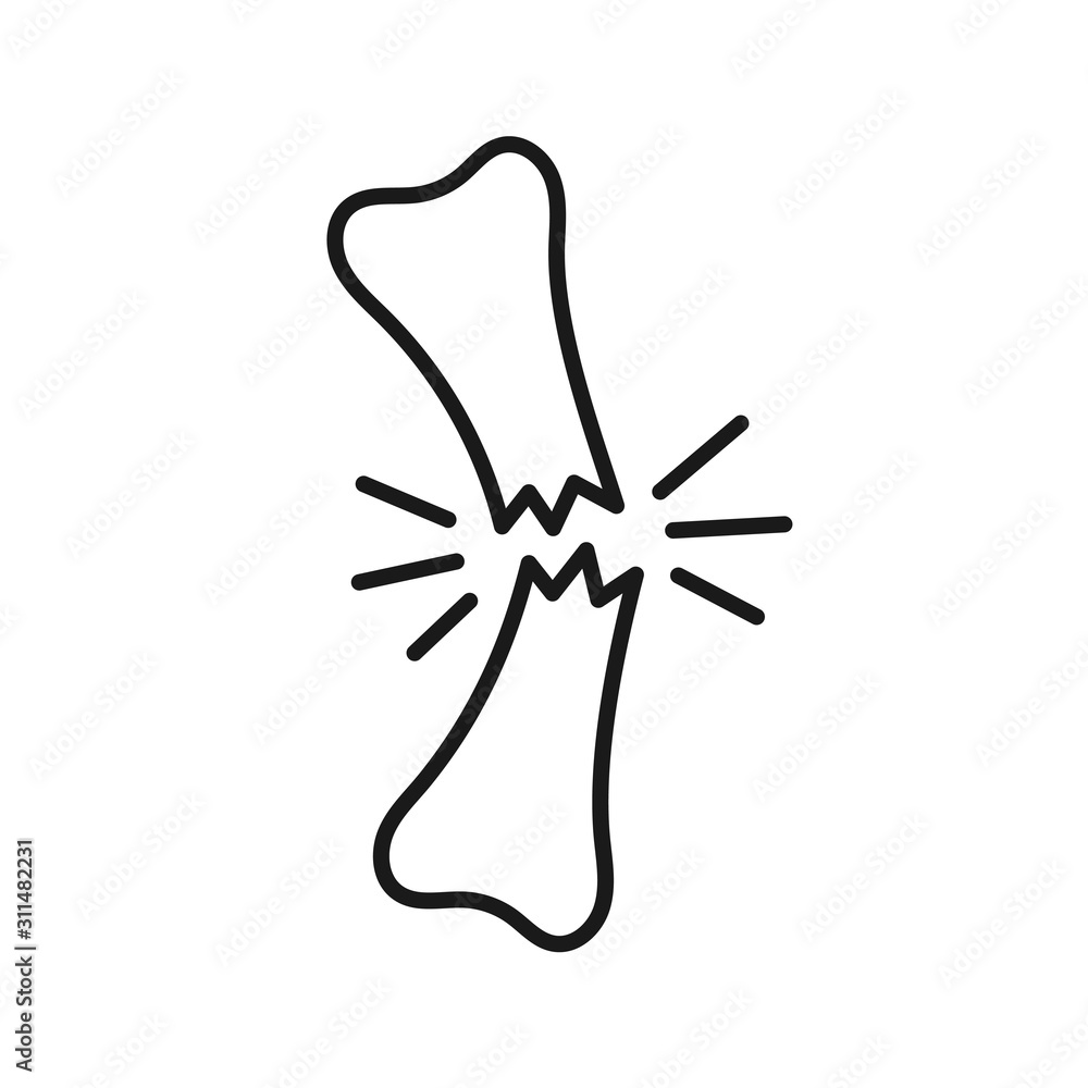 Icon of broken bone. Vector illustration of bone fracture in outline ...