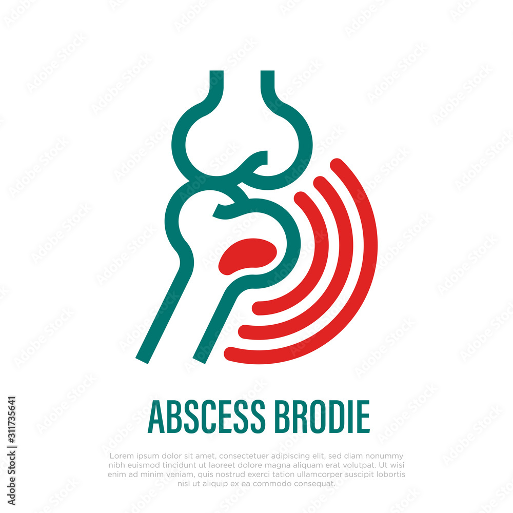 Brodie abscess thin line icon. Inflammation and pain in joint. Vector ...