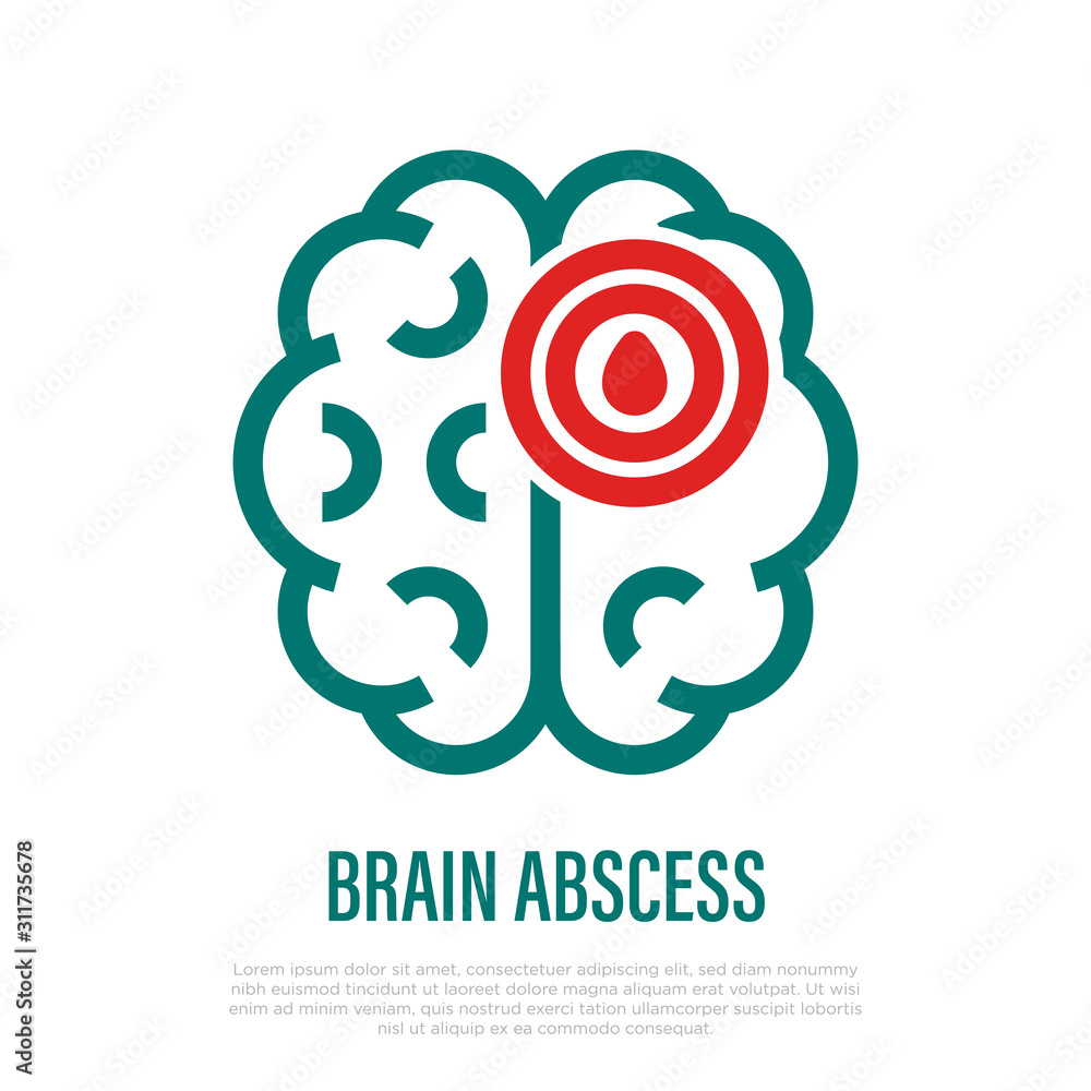 Brain abscess thin line icon. Inflammation and pain in brain. Headache ...