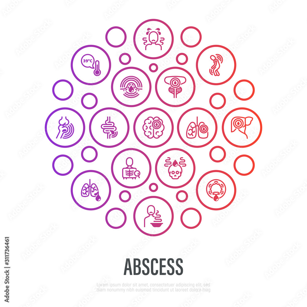 Abscess concept in circle shape with thin line icons. Joint, abdominal ...