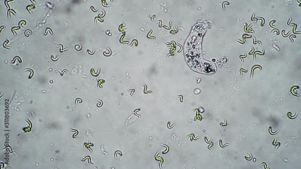 Amoeba moving in the water between the algae timelapse. Theme of ...