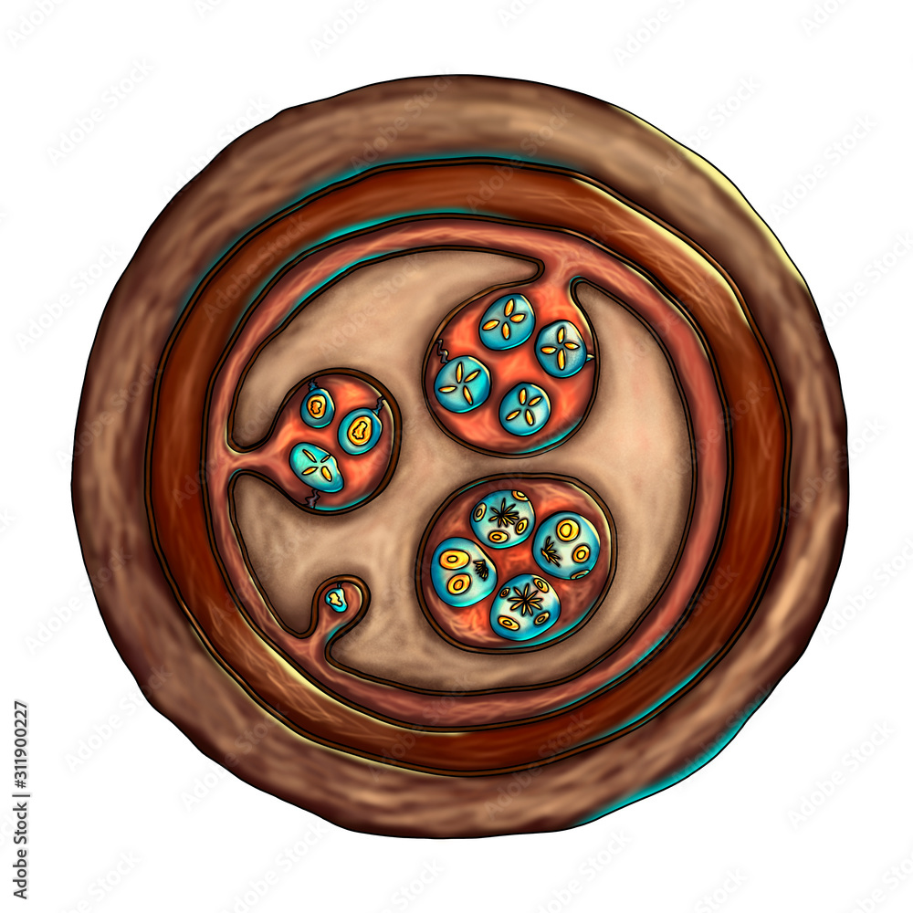 Echinococcus Granulosus Hydatid Cyst