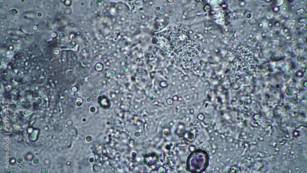 Movement of milk bacteria in milk leaven under a microscope. The theme ...
