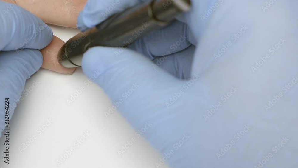 Vidéo Stock doctor punctures female finger with lancing device and ...