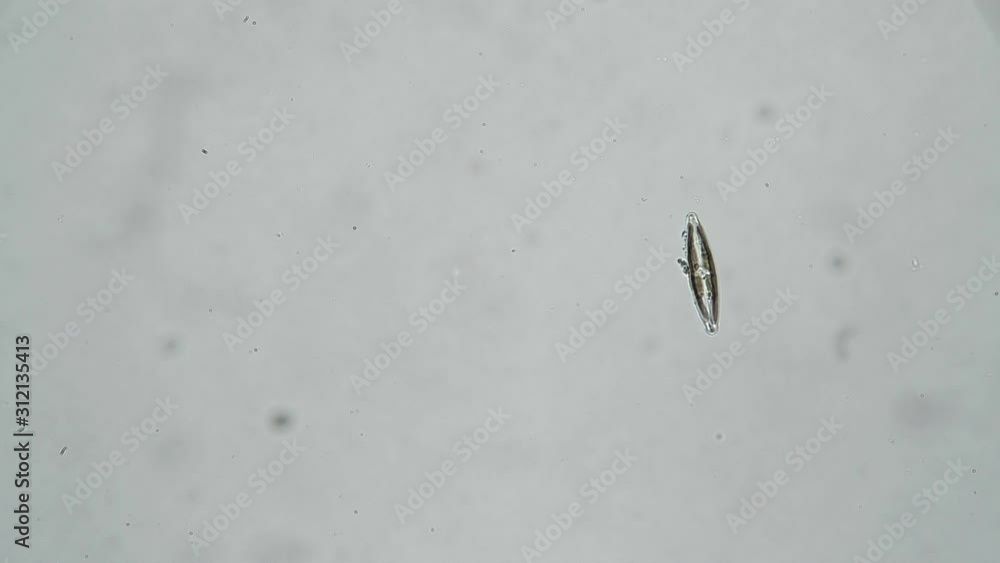 Vidéo Stock Diatoms algae cymbella floating in water on a white ...