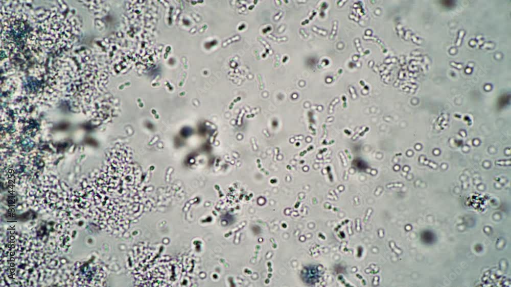 A lot of bacteria and bacilli in a drop of ferment for fermented milk ...