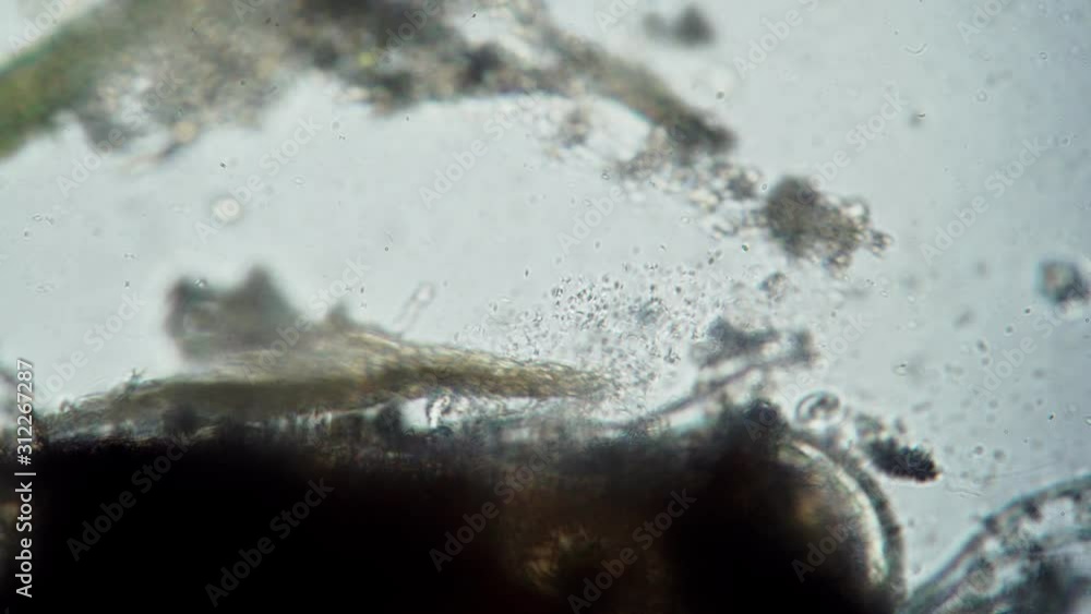 Large colony of bacteria on a dust mite trum microcosm background ...