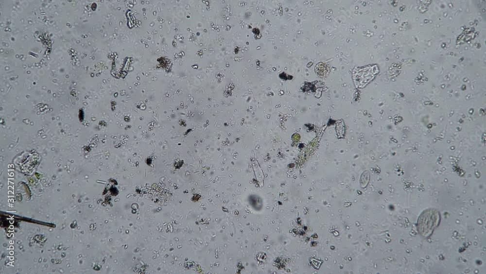 Biological background from a microcosm with microorganisms on a white ...