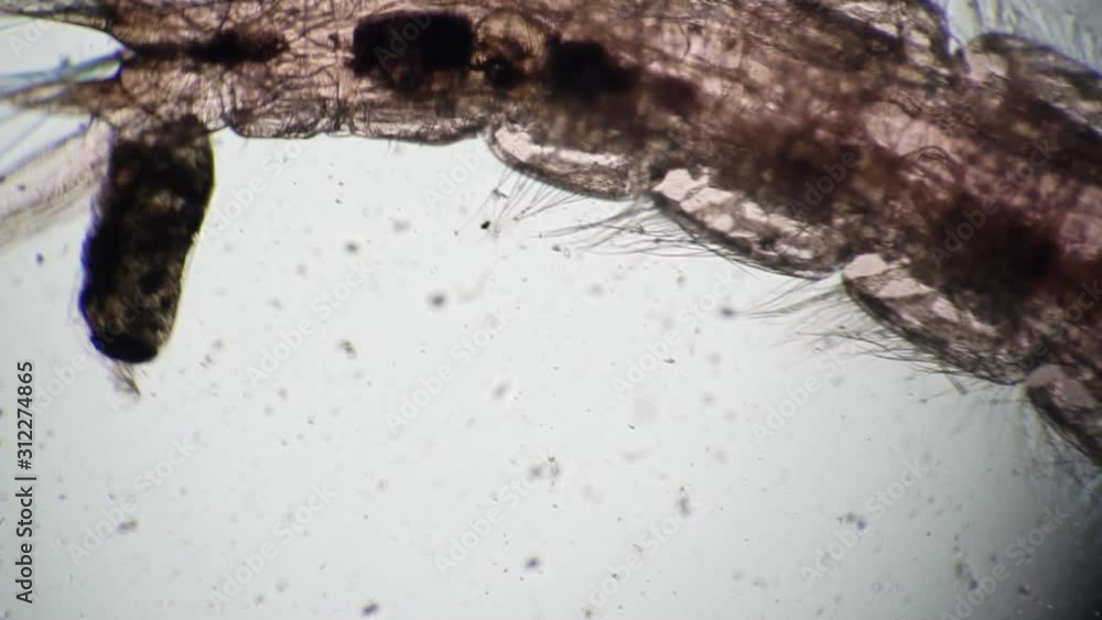 Defecation of the microorganism from the worm in microscope. Theme of ...