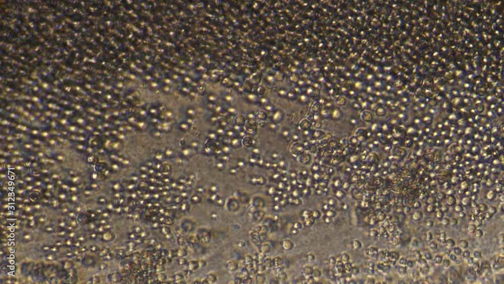 Microscopy of yeast cells (Saccharomyces cerevisiae). Magnification ...