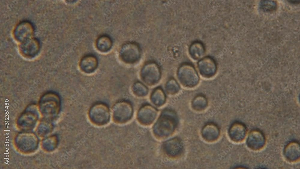 Microscopy of yeast cells (Saccharomyces cerevisiae). Magnification ...