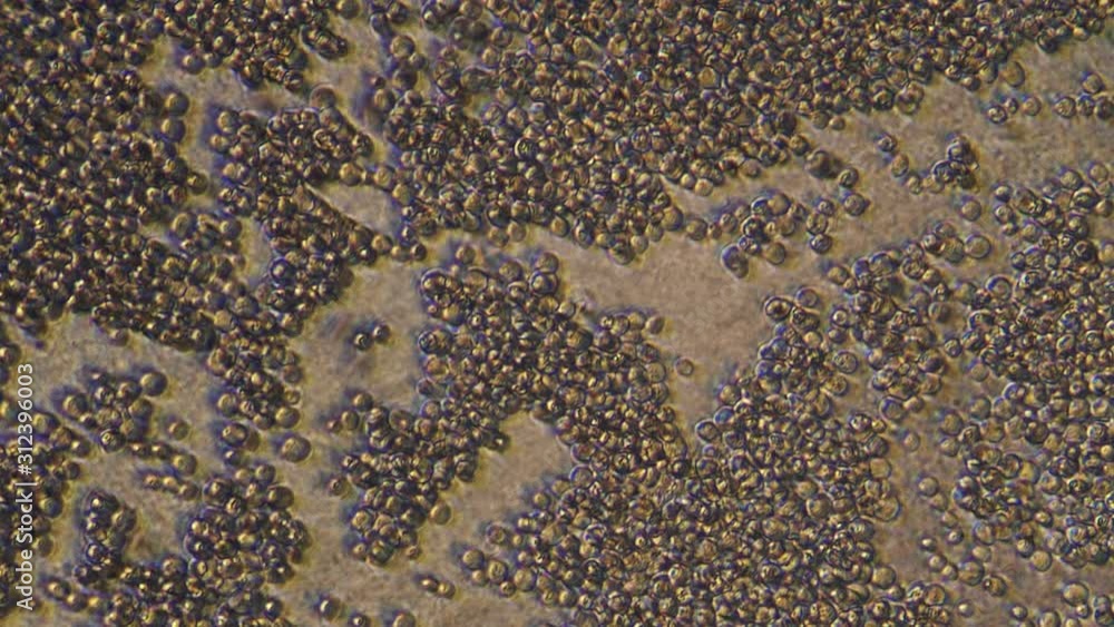 Microscopy of yeast cells (Saccharomyces cerevisiae). Magnification ...