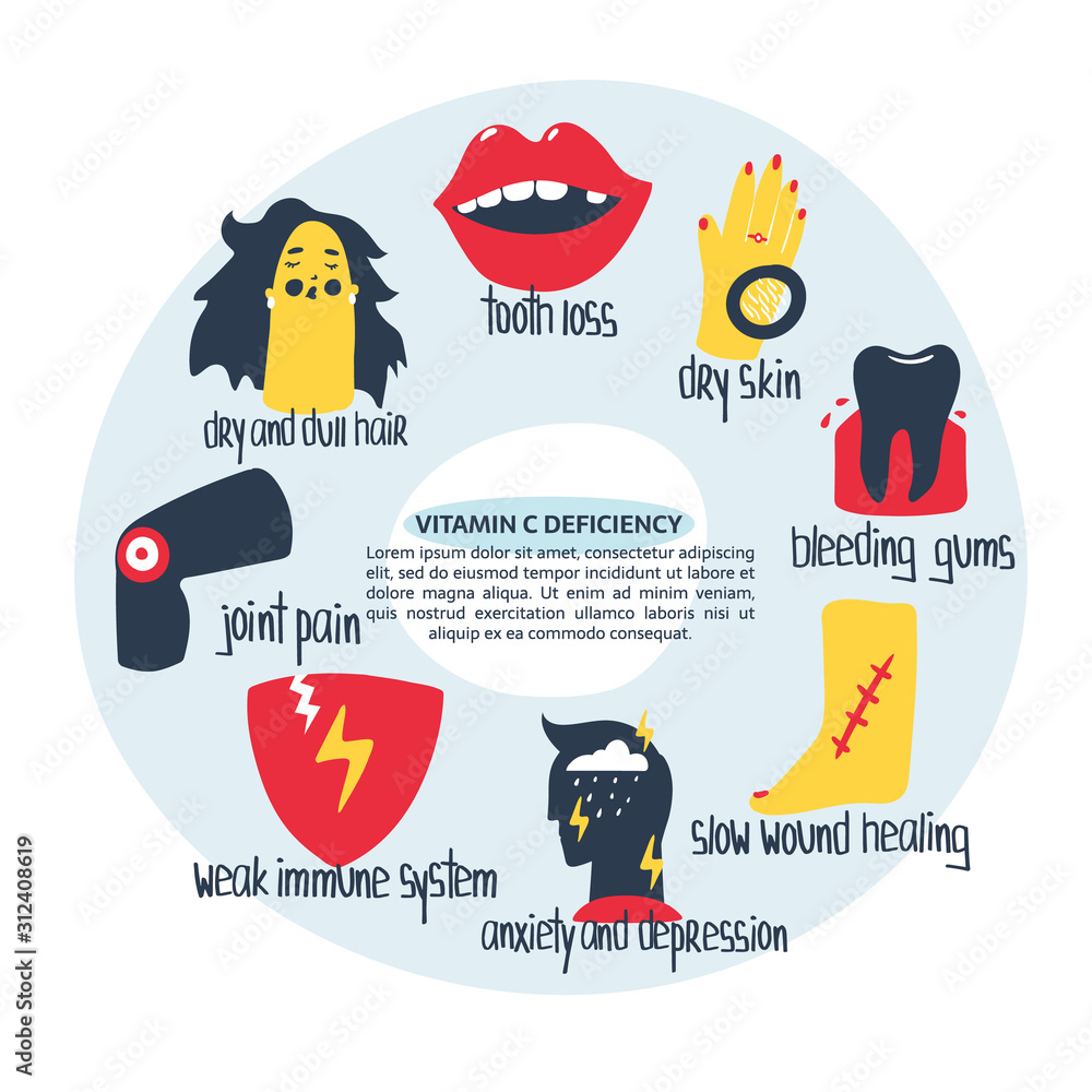 Hand drawn vitamin C ascorbic acid deficiency: dry skin, hair, joint ...
