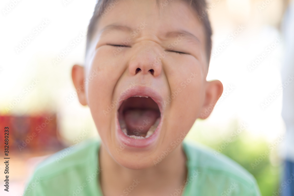 Good morning. Cute boy woke up with a swollen face Stock Photo | Adobe ...