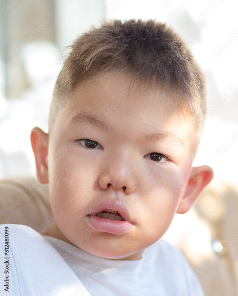 Good morning. Cute boy woke up with a swollen face Stock Photo | Adobe ...