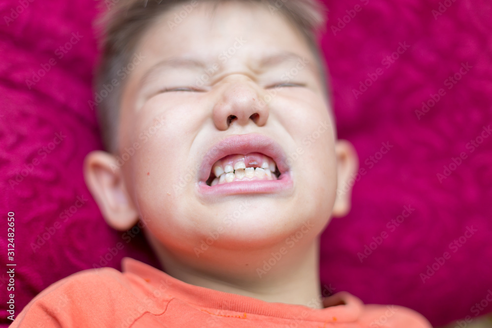 the boy laughs and shows the first tooth. children's teeth, loss and ...