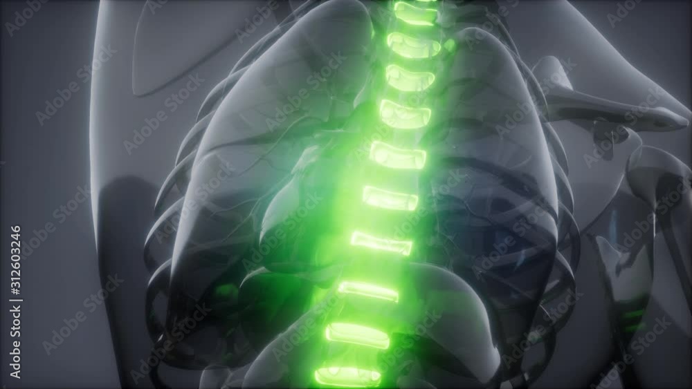 backache in backbone. science anatomy scan of human spine bones glowing ...