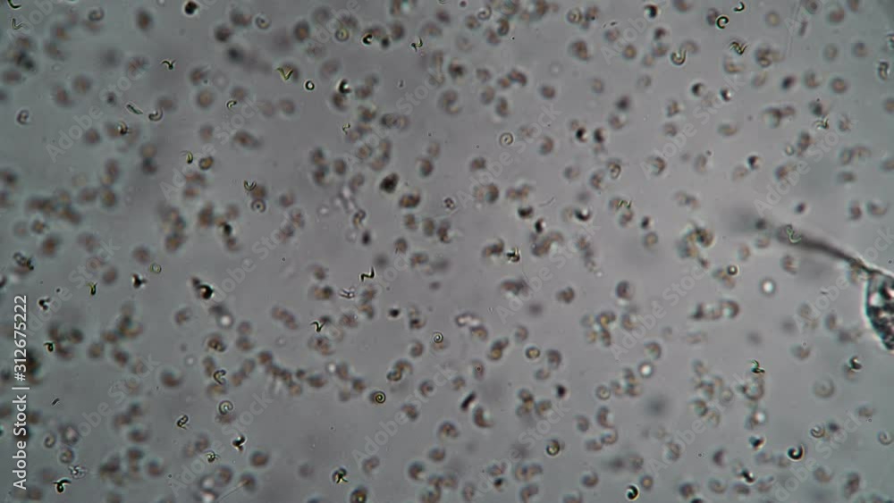 Observation of the ciliate vorticella under the microscope. Theme of ...