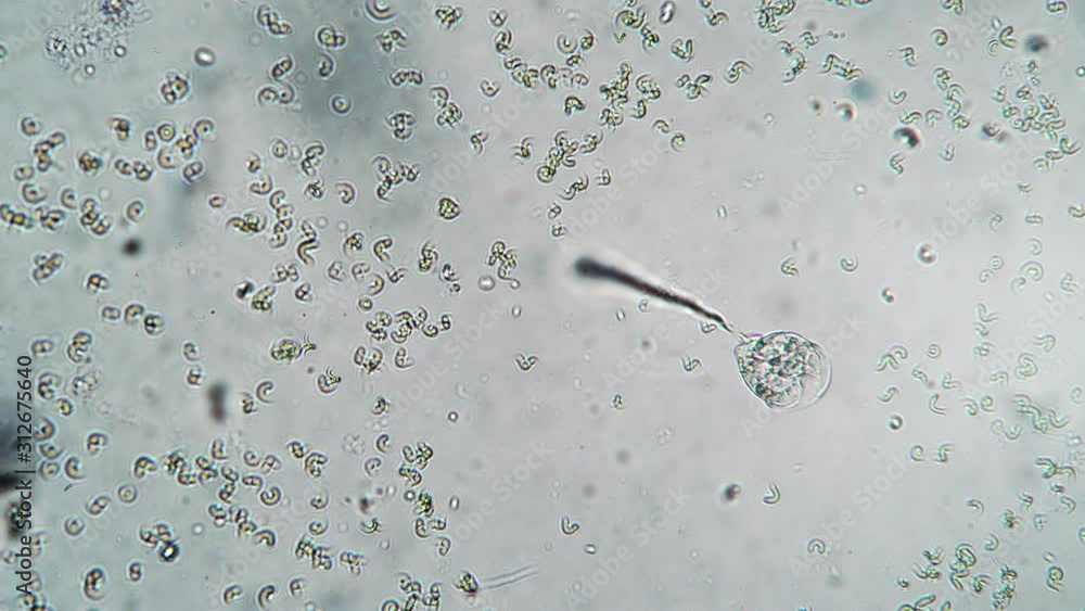 Infusoria vorticella shrinks sharply and then begins to float. Theme of ...
