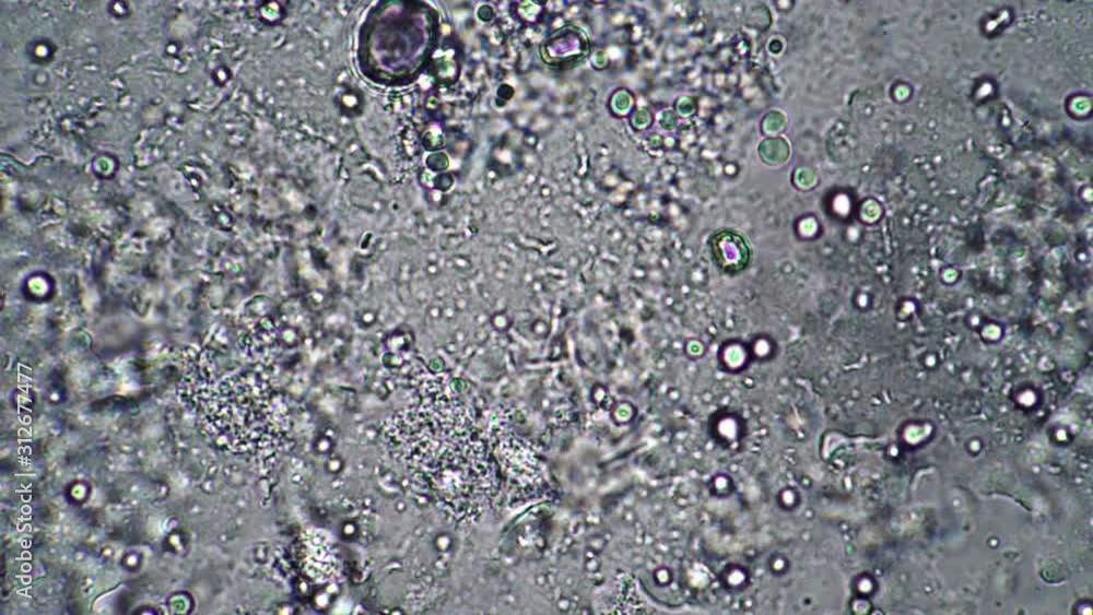 Lactic acid bacilli in leaven from milk under a microscope. Microcosmic ...