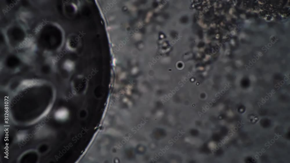 The focus of the microscope at the bacteria and sticks. The theme of ...