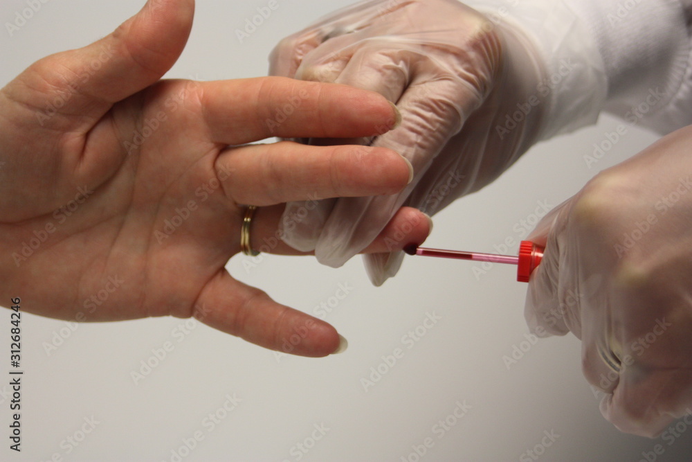 lab draw fingerstick Stock Photo | Adobe Stock