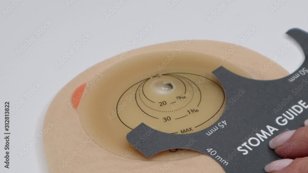 Colostomy bag, supply needed after colostomy surgery - colon cancer ...