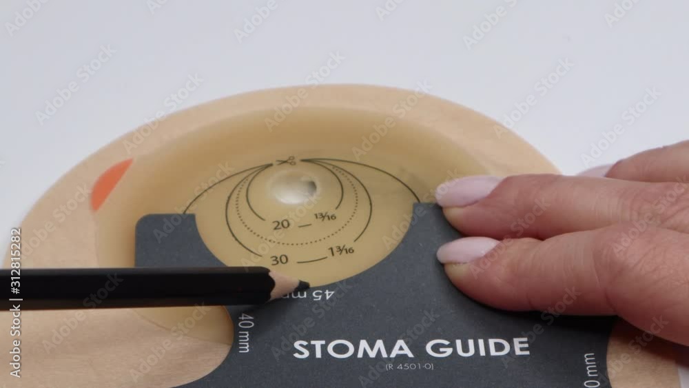 Colostomy bag, supply needed after colostomy surgery - colon cancer ...