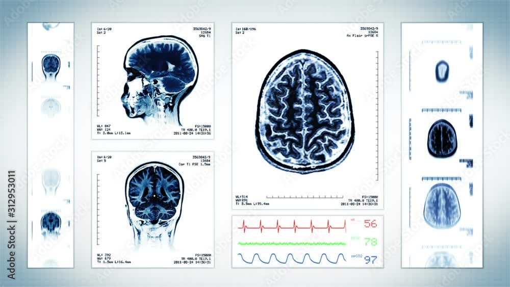 Brain MRI Scan. White. 4 videos in 1 file. Animation showing top, front ...