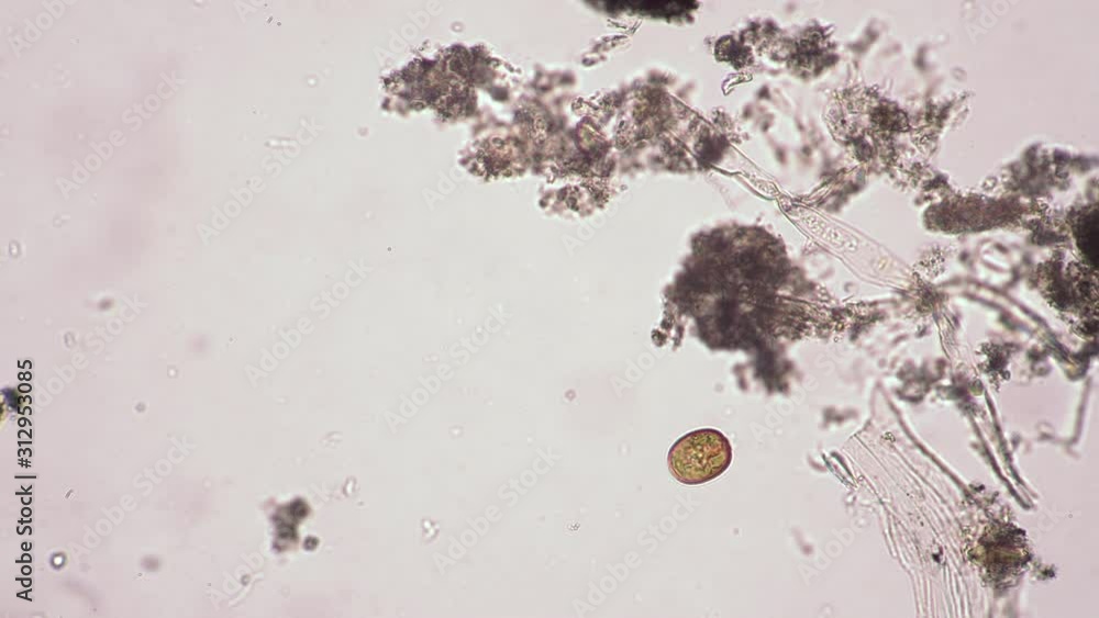 The infusoria floats in river water in a microscope. Theme of ...